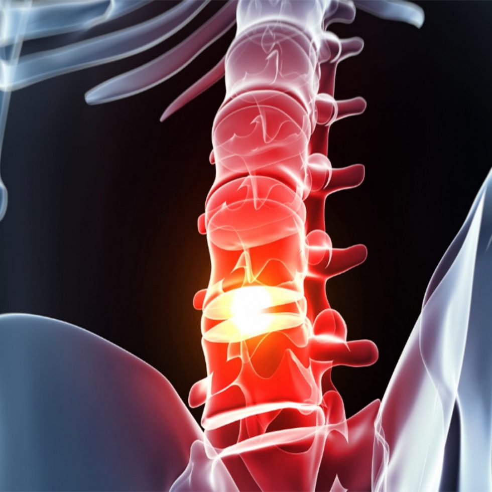 La función de un neurocirujano: ¿Qué patologías opera? - Neurocirugía ...