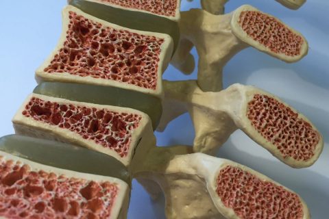 Comprendiendo la Discopatía Degenerativa Lumbar: Causas, Síntomas y ...